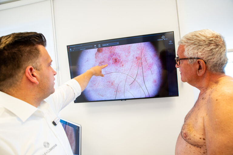 Hautkrebsvorsorge mit dem Fotofinder und KI - Dr. med. Max Tischler